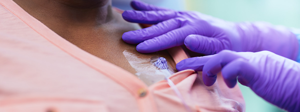 Central Catheters | ICU Medical